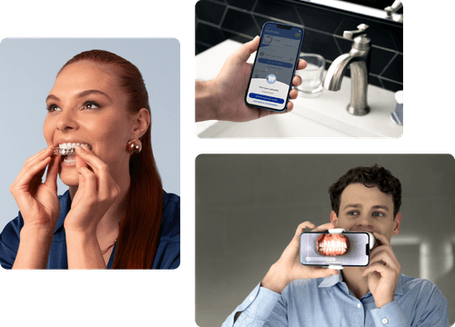 ProMonitoring - Powerful Remote Clear Aligner Monitoring